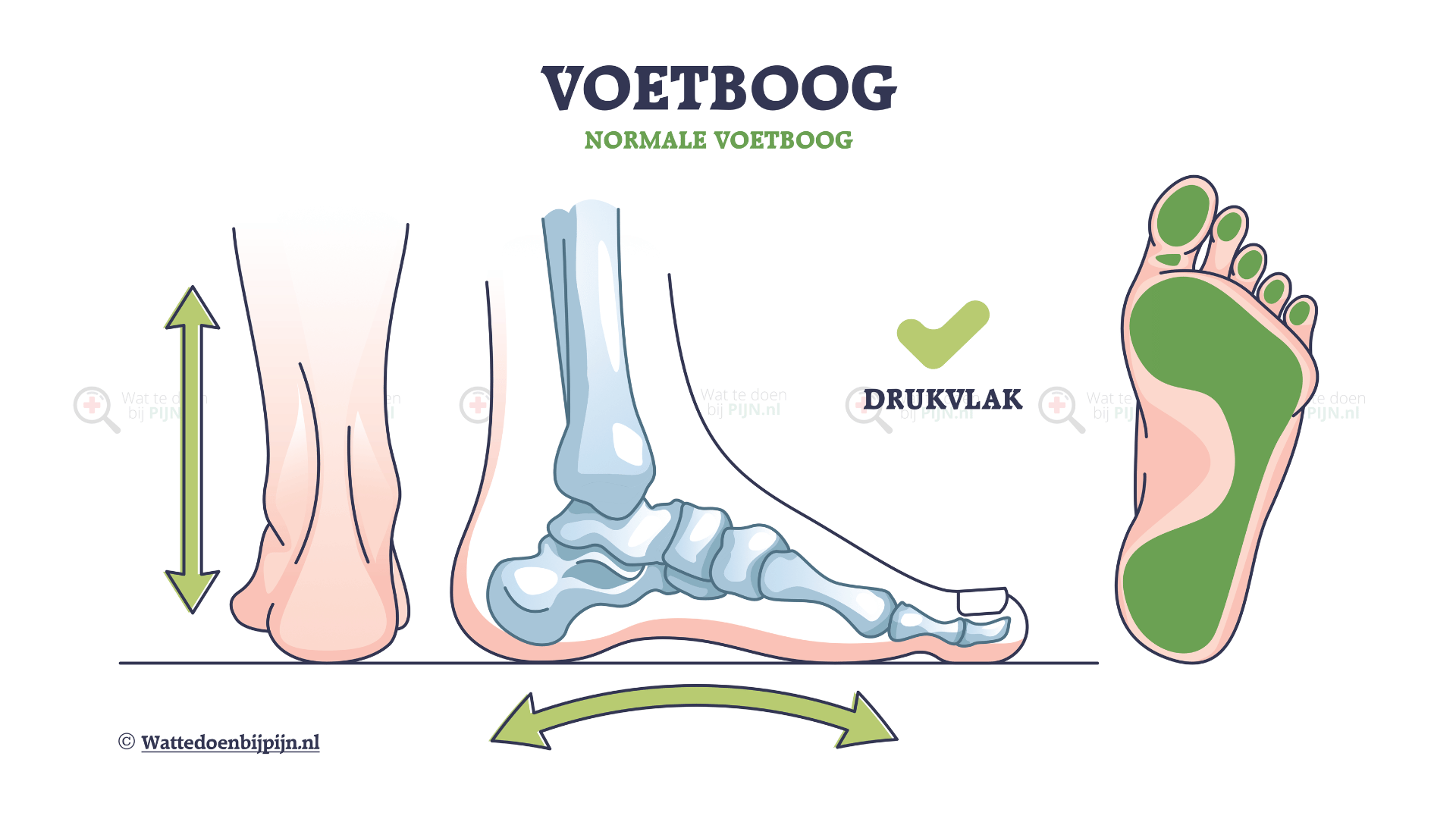 Hielspoor oorzaak | Wat te doen bij PIJN.nl